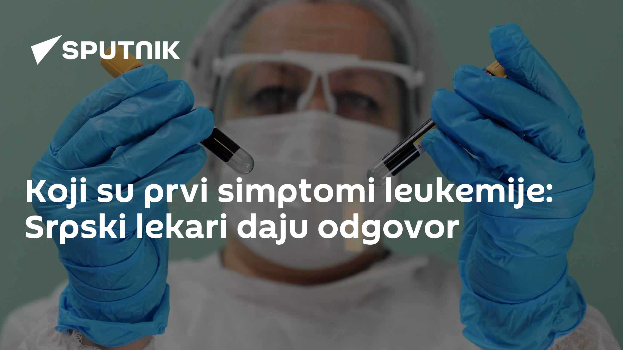 Koji su prvi simptomi leukemije: Srpski lekari daju odgovor - 27.03. ...