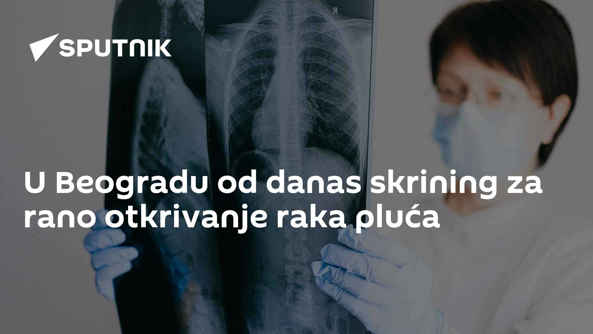 U Beogradu od danas skrining za rano otkrivanje raka pluća - 07.11.2024, Sputnik Srbija